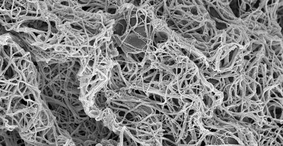 Stopping heavy bleeding with next-generation artificial platelets ...